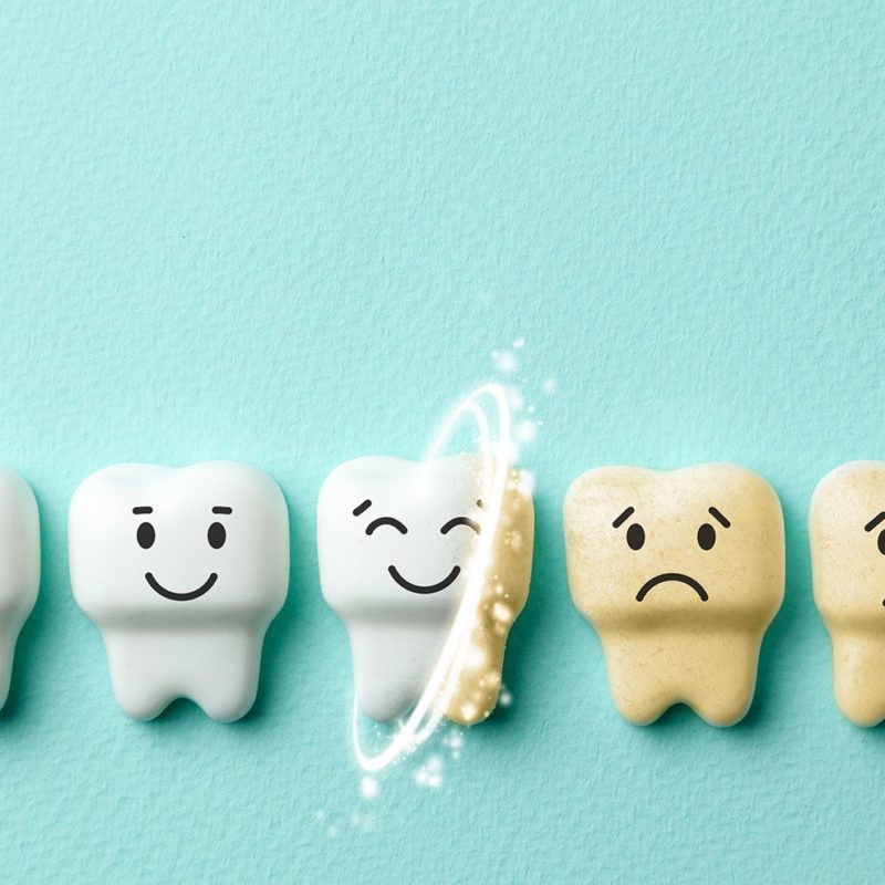 The 3 Best and Worst Candies for Your Teeth - Ask the Dentist