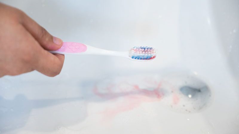 Bleeding Gums: What It Means and When to See Your Dentist