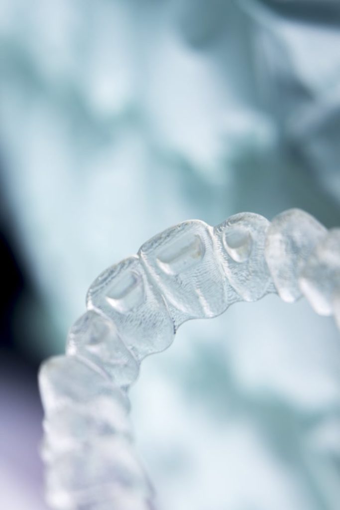 Invisalign: Know Before You Go