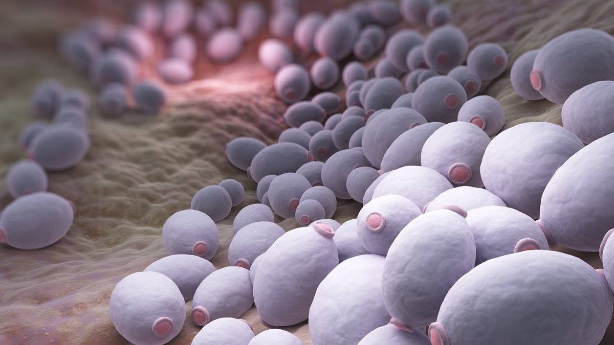 Oral Thrush: Home Remedies, Causes, Symptoms & More - Ask the Dentist