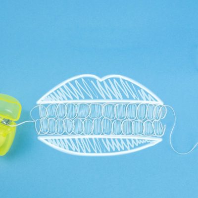 How Bad Is Not Flossing? - Ask the Dentist