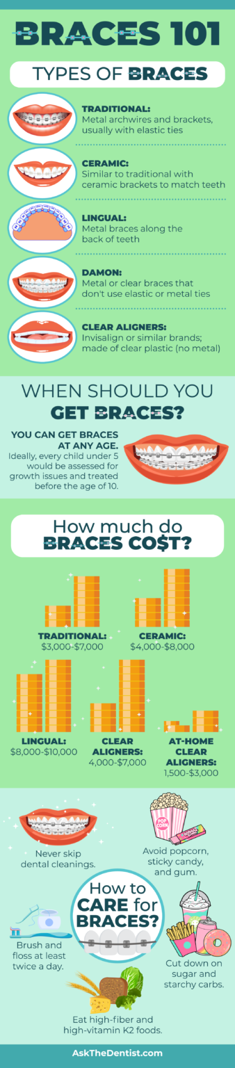 Braces: Types, What to Expect, How They Work & Care (Kids + Adults)